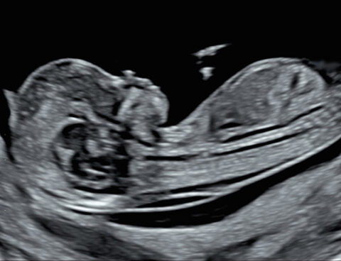 Jupiter Ultraljudsmottagning - Jupiter Ultraljudsmottagning